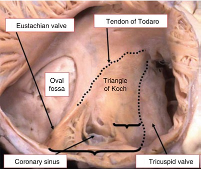 Anatomy and Physiology of the Atrioventricular Node: What Do We Know ...