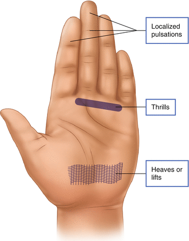 Introduction to Cardiac Auscultation | SpringerLink