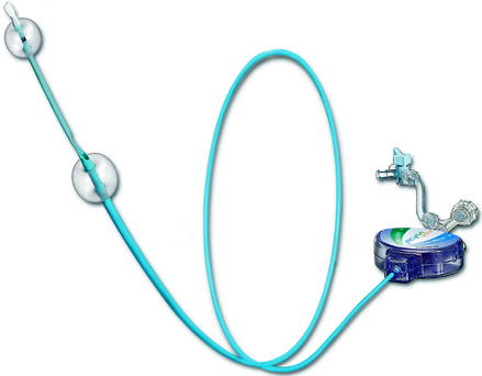 Embolic Protection Devices | SpringerLink