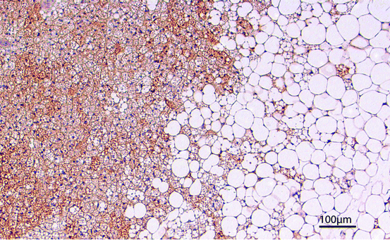 Brown Adipose Tissue | SpringerLink