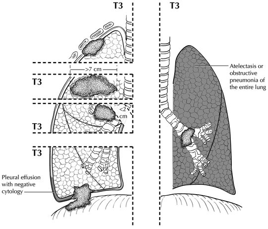 Lung | SpringerLink