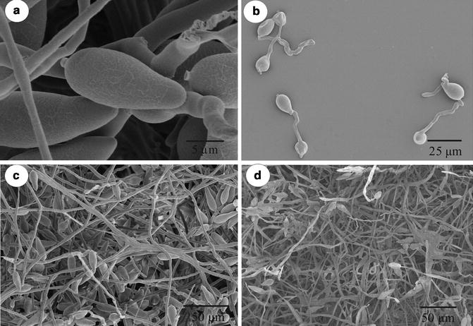 Scanning Electron Microscopy for Fungal Sample Examination | SpringerLink
