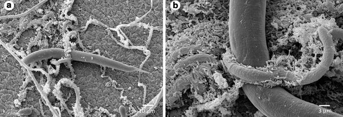 Scanning Electron Microscopy for Fungal Sample Examination | SpringerLink
