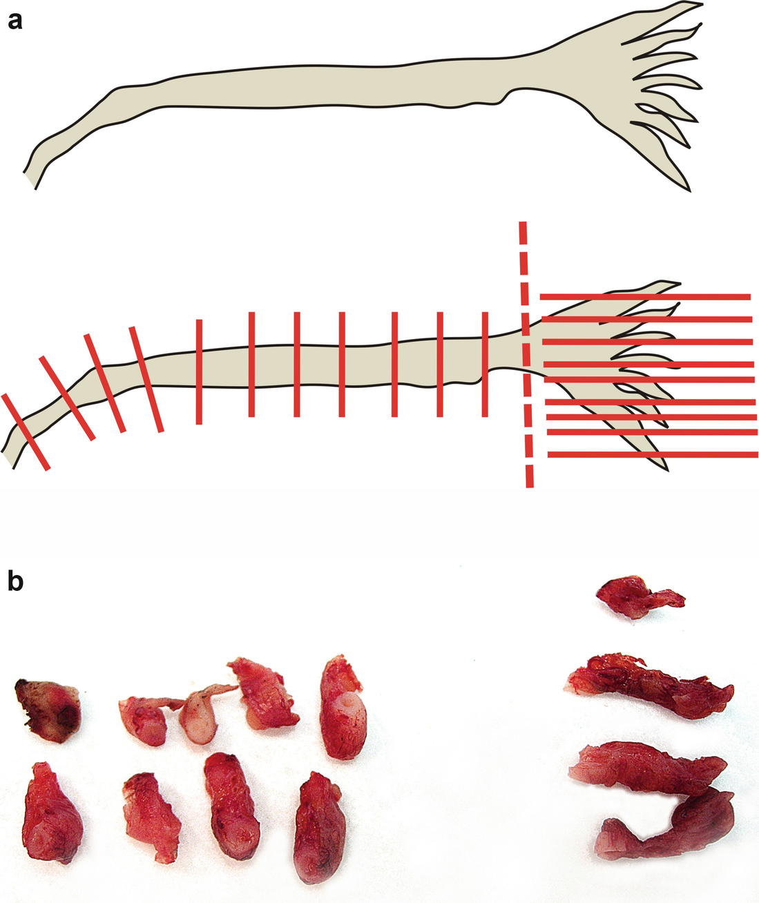 Diseases of the Fallopian Tube and Paratubal Region | SpringerLink