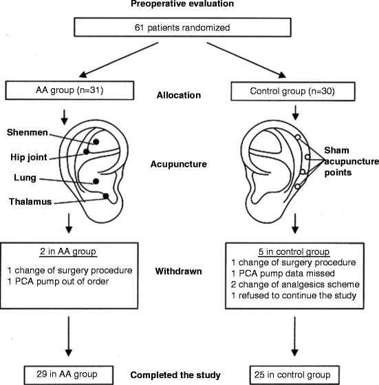 Development and Progression of Auricular Acupuncture as a Treatment for ...
