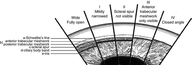 Gonioscopy | SpringerLink