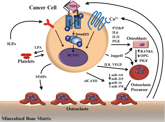 Pathobiology of Osteolytic and Osteoblastic Bone Metastases | SpringerLink