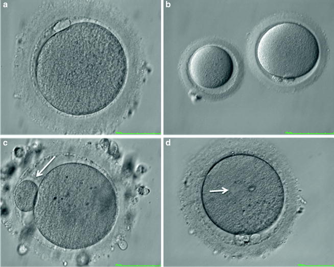 Morphological Assessment of Oocytes, Pronuclear and Cleavage Stage ...
