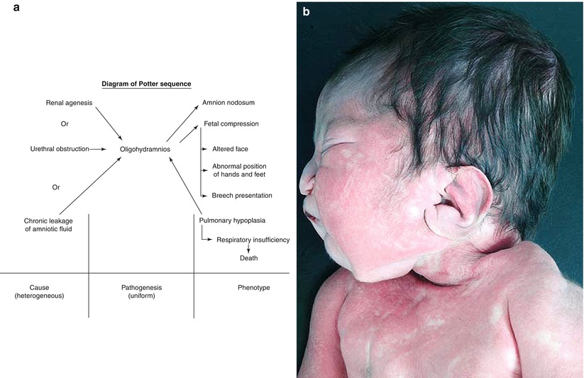 Congenital Abnormalities | SpringerLink