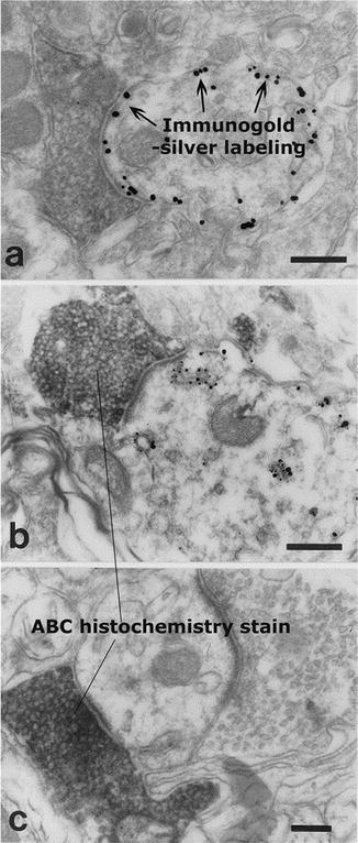 Brain Tissue Preparation, Sectioning, and Staining | SpringerLink