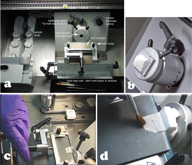 Brain Tissue Preparation, Sectioning, and Staining | SpringerLink
