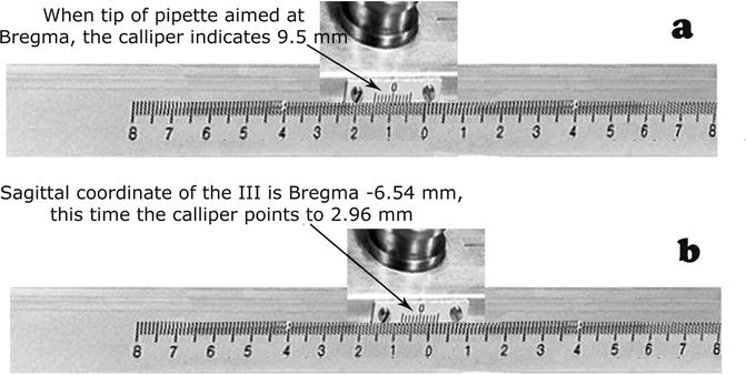Brain Stereotaxic Injection | SpringerLink
