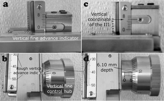 Brain Stereotaxic Injection | SpringerLink