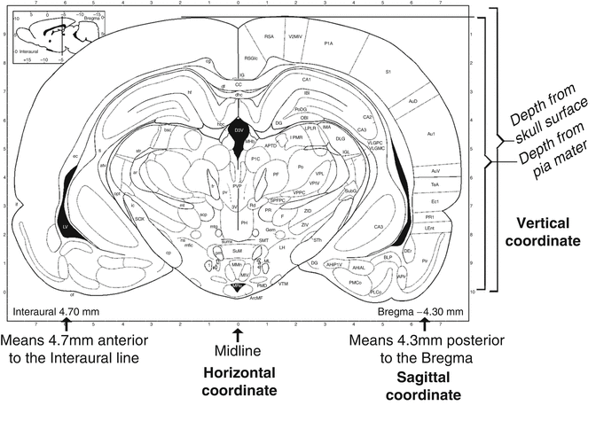 Brain Stereotaxic Injection | SpringerLink