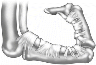 Functional Anatomy and Biomechanics of the Hand | SpringerLink