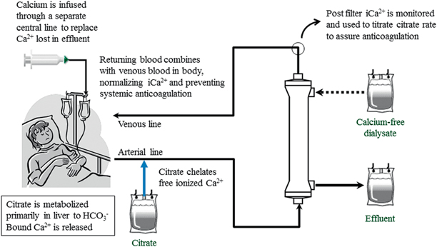 Complications of Continuous Renal Replacement Therapy (CRRT) | SpringerLink