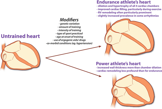 Exercise-Induced Right Heart Disease in Athletes | SpringerLink