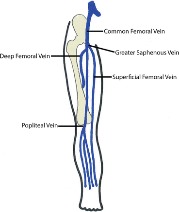 Intensive Care Unit Ultrasound for Venous Thromboembolism | SpringerLink