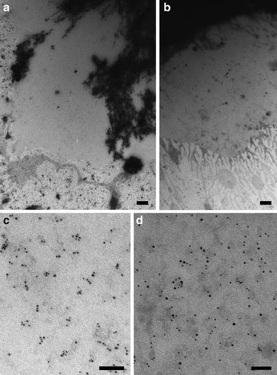Electron Microscopy Methods for Studying Plasma Membranes | SpringerLink