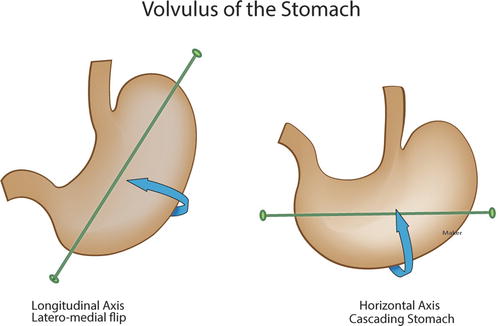 Stomach | SpringerLink
