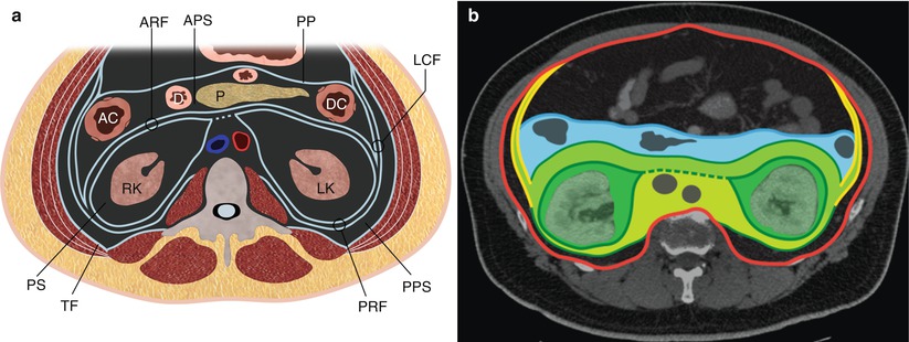 The Extraperitoneal Spaces | SpringerLink