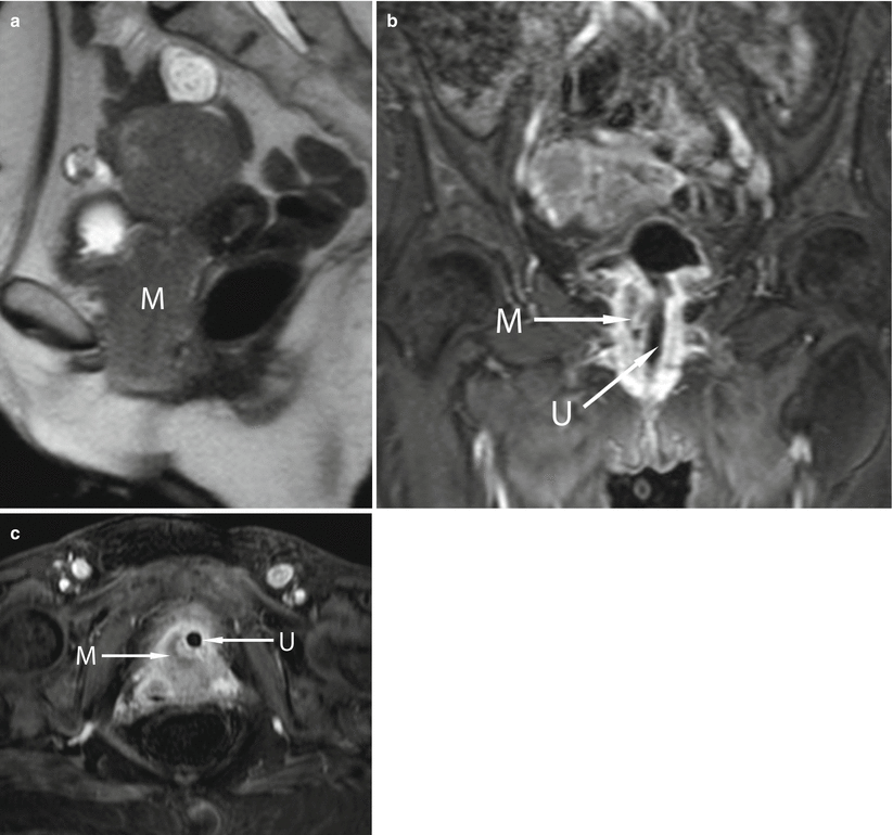 Cross Sectional Imaging Of The Female Urethra Springerlink