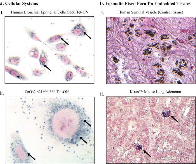Sudan Black B, The Specific Histochemical Stain for Lipofuscin: A Novel ...