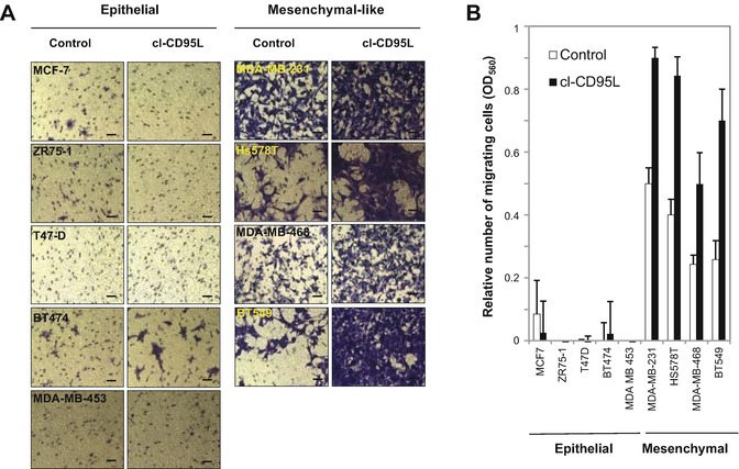 Boyden Chamber Assay to Study of Cell Migration Induced by ...