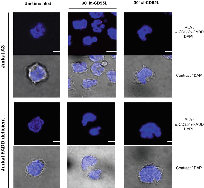 Proximity Ligation Assay (PLA) to Evaluate DISC and MISC Composition ...
