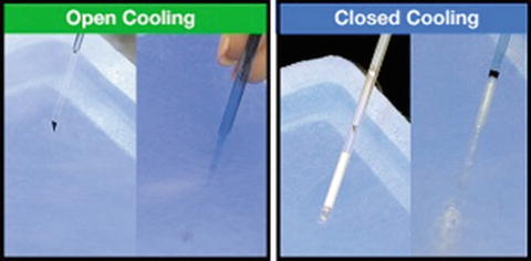 Appendix A: Cryotech® Vitrification Thawing | SpringerLink