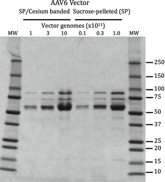 AAV6 Vector Production and Purification for Muscle Gene Therapy ...