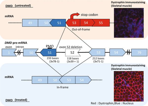 Exon Skipping Therapy Using Phosphorodiamidate Morpholino Oligomers in ...