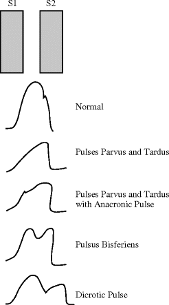 Physical Examination in Valvular Heart Disease | SpringerLink