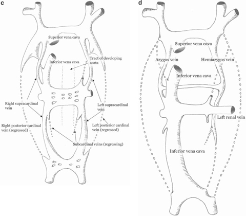 Inferior Vena Cava: Embryology and Anomalies | SpringerLink
