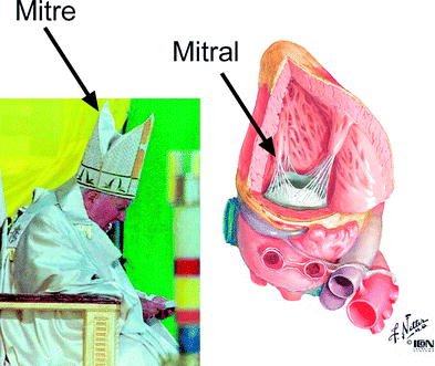 Anatomy of the Human Heart | SpringerLink