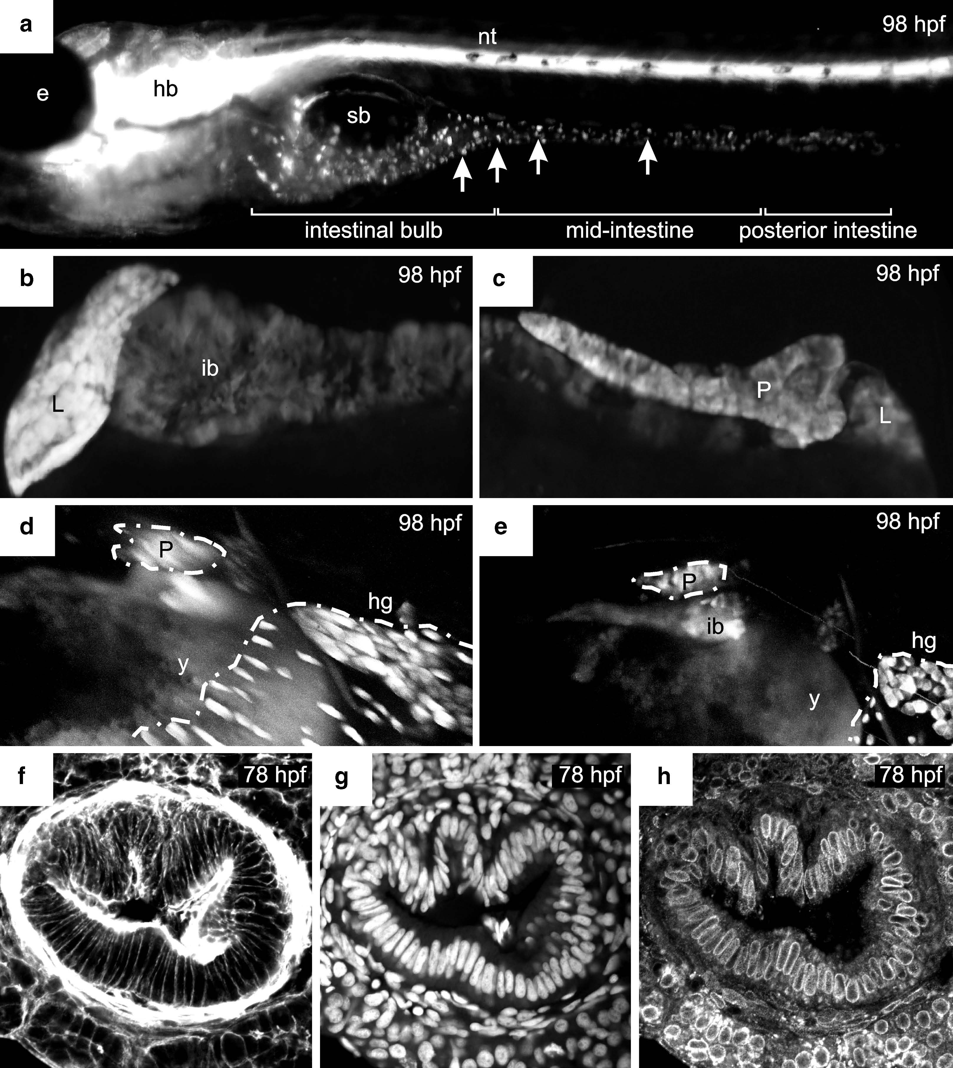 Morphological Analysis of the Zebrafish Digestive System | SpringerLink