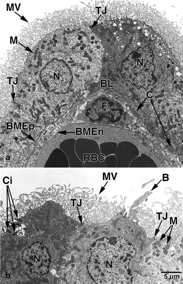 The Blood–Cerebrospinal Fluid Barrier: Structure and Functional ...