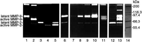 Assessment of Gelatinases (MMP-2 and MMP-9) by Gelatin Zymography ...