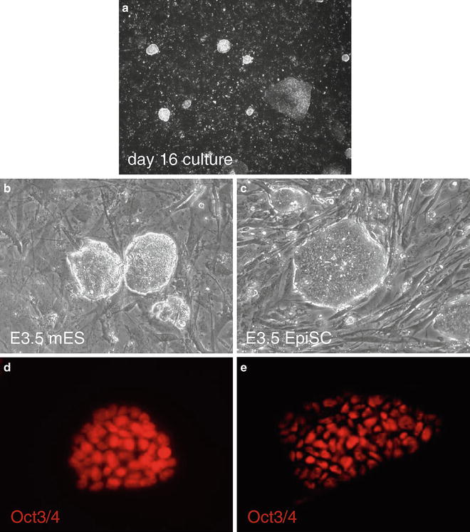 Generation and Characterization of Epiblast Stem Cells from Blastocyst ...