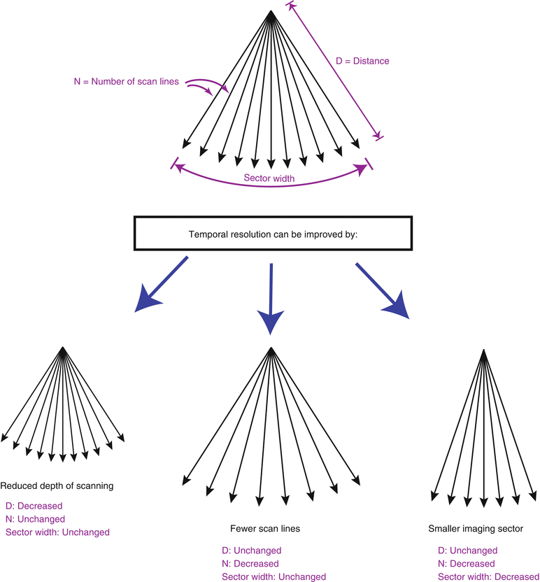 Science of Ultrasound and Echocardiography | SpringerLink