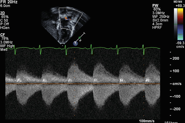 Science of Ultrasound and Echocardiography | SpringerLink