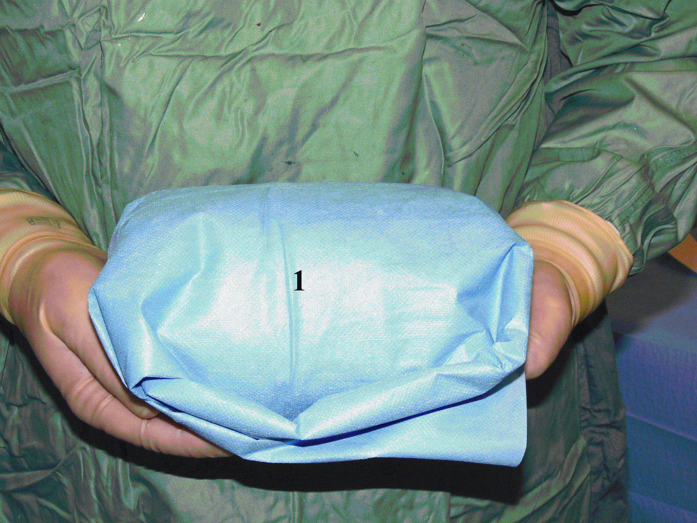 Organ Packing | SpringerLink