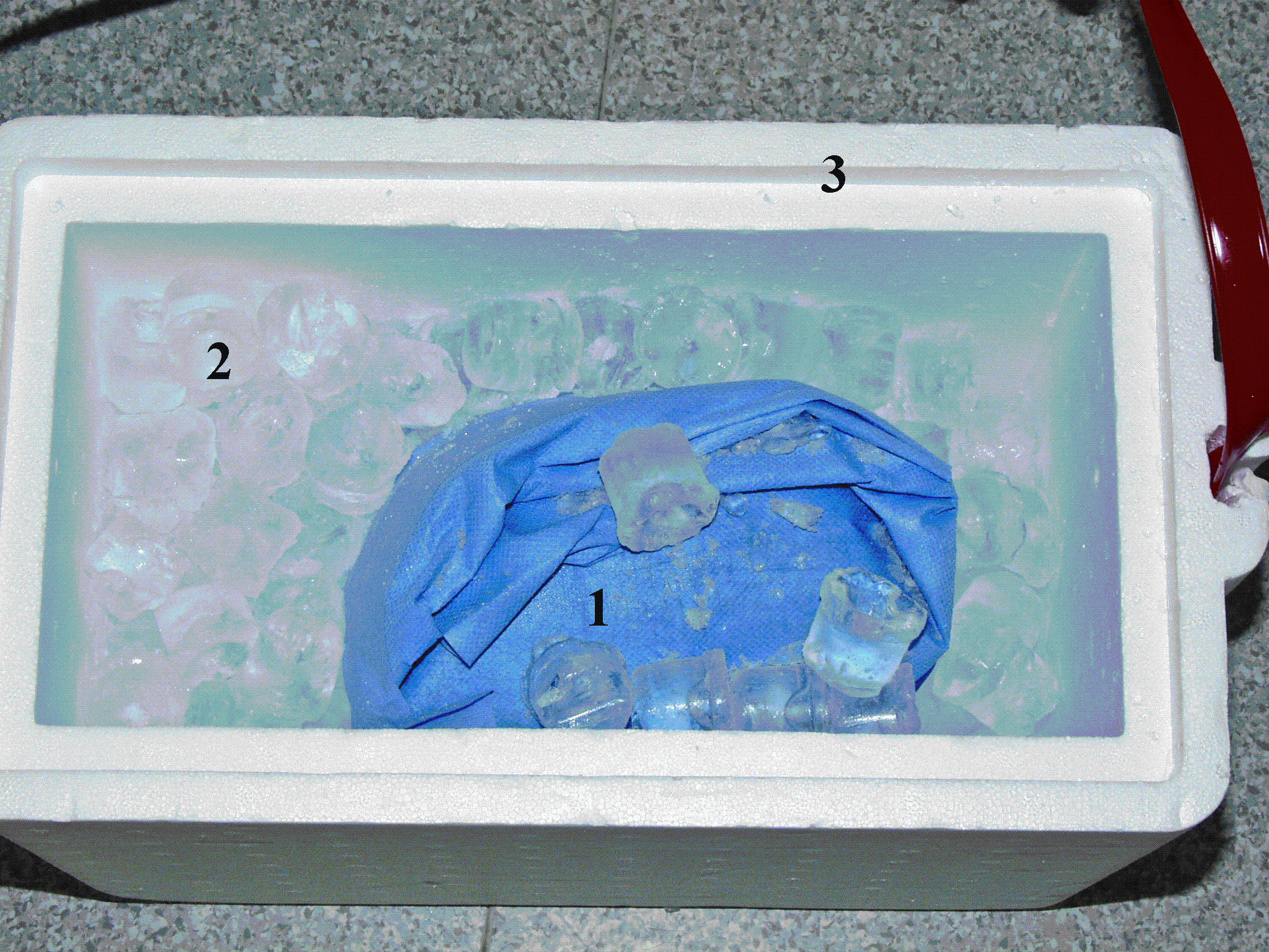 Organ Packing | SpringerLink