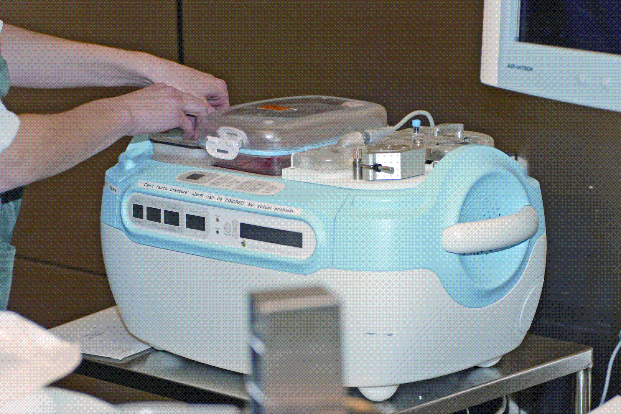 Organ Packing | SpringerLink