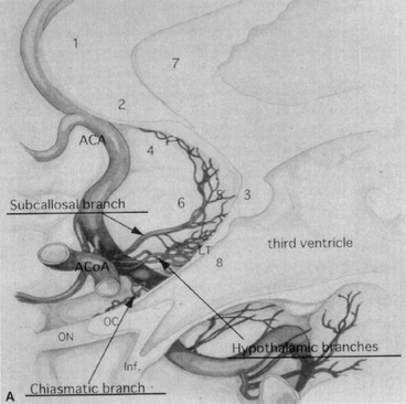 Perforating Branches of the Anterior Communicating Artery: Anatomy and ...