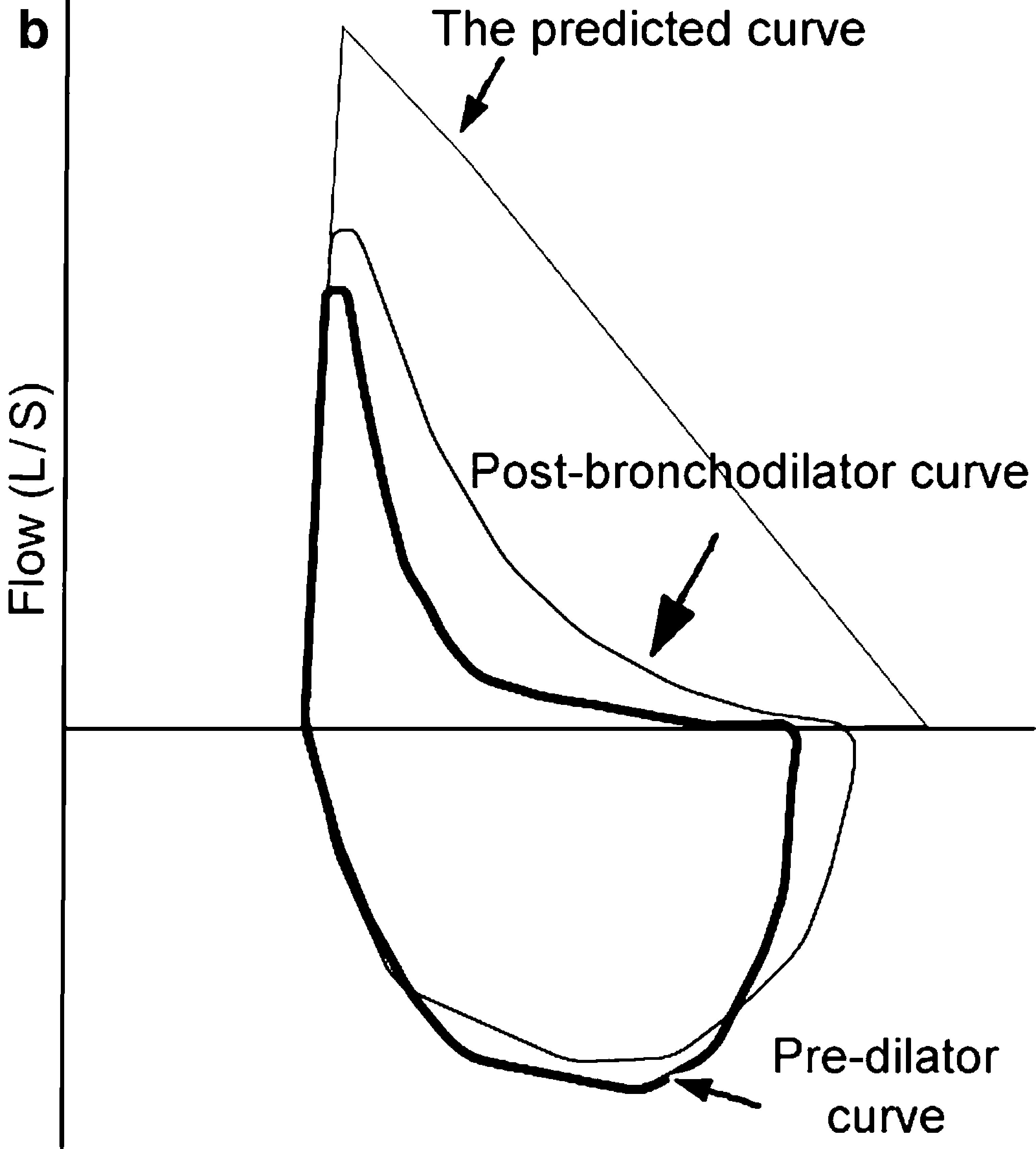 Spirometry | SpringerLink