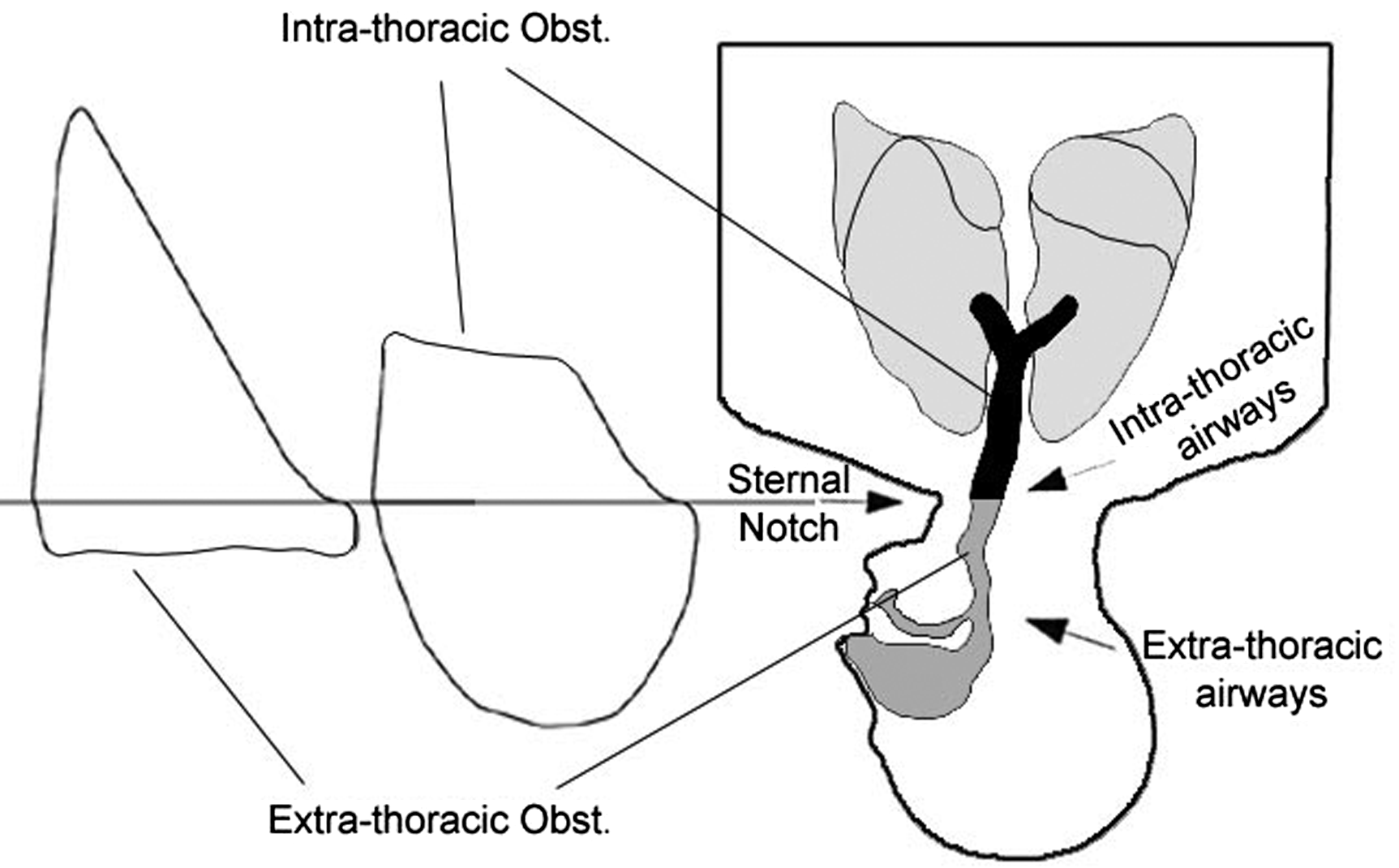 Spirometry | SpringerLink