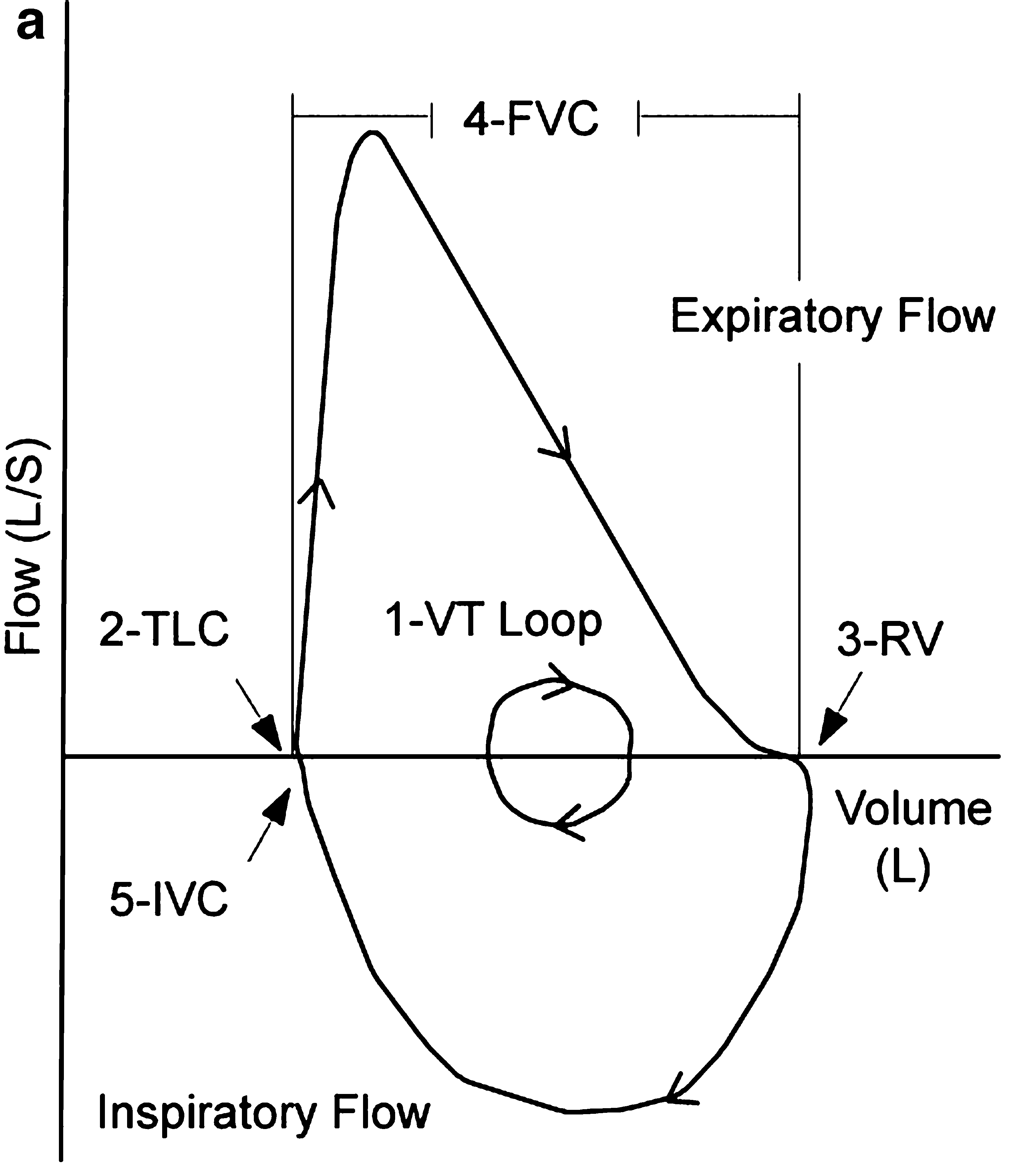 Spirometry | SpringerLink