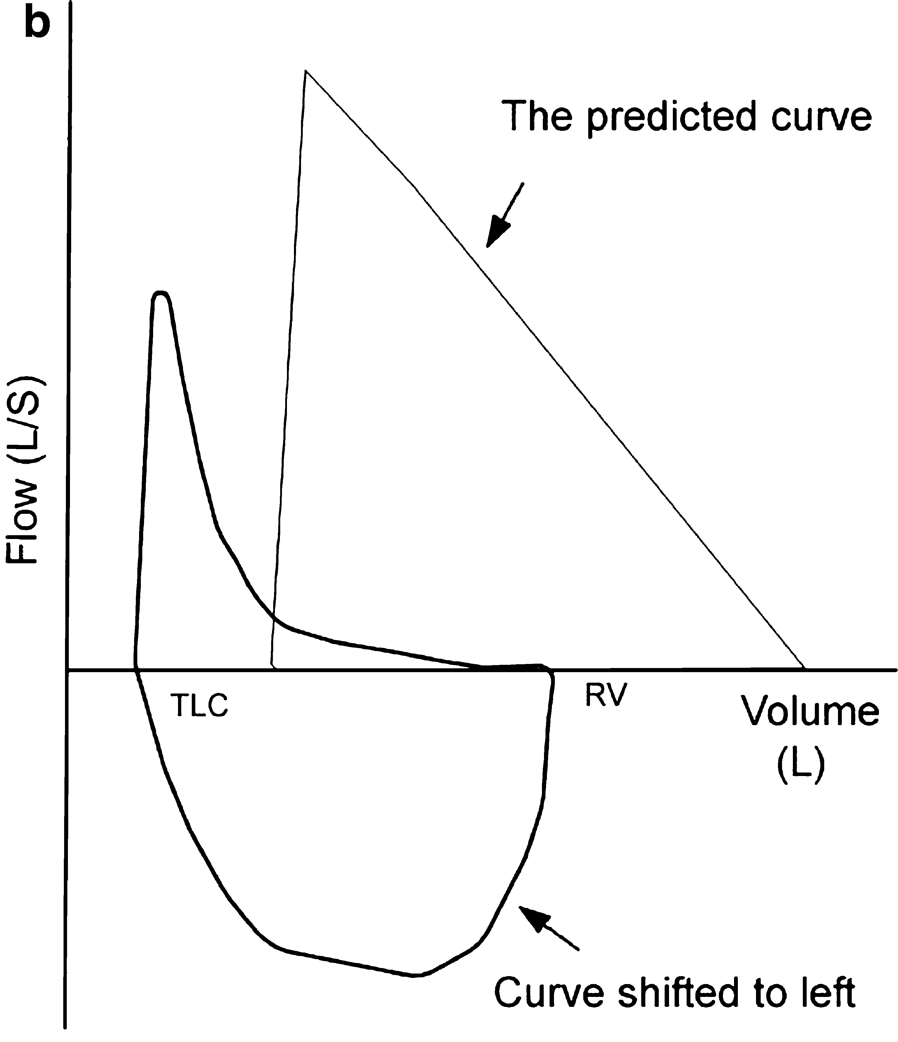Lung Volumes | SpringerLink