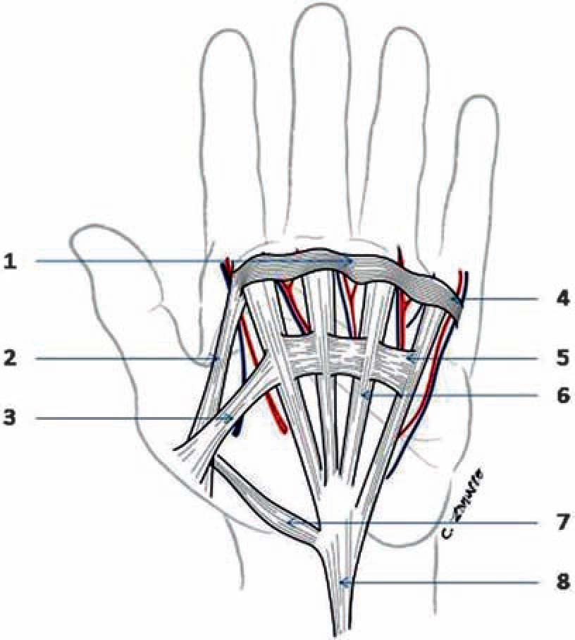 Acquired Diseases of the Hand (Rheumatoid Arthritis and Dupuytren's ...